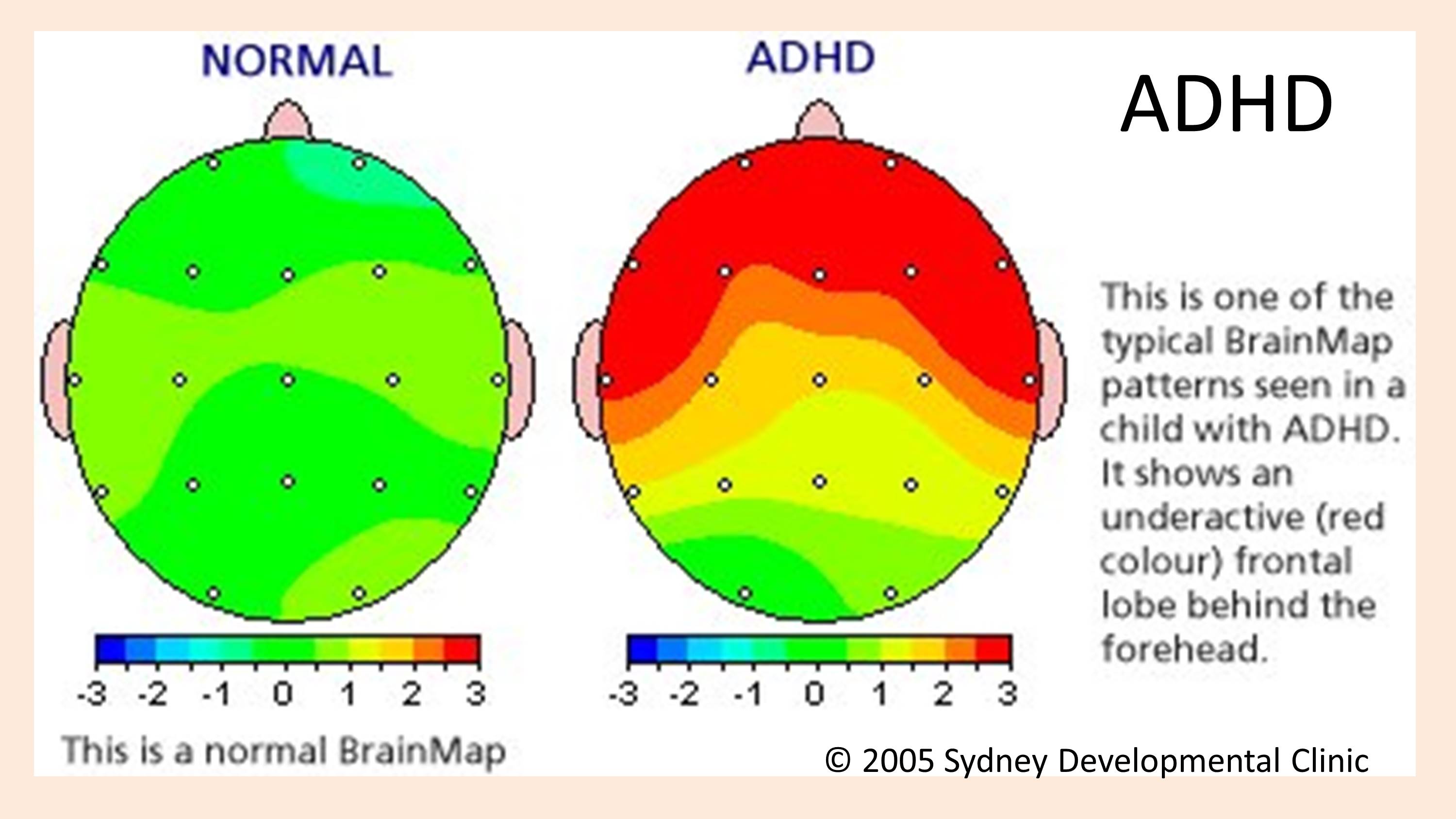 Different Brains • Evidence Based Teachers Network